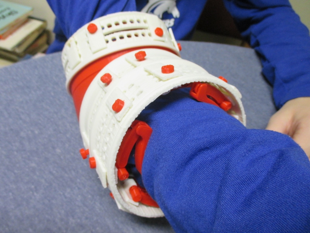 Meet the Winners of the 2017 Extreme Redesign Challenge